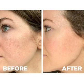 DEROL Anti-Aging Balm (BUY 1 GET 1 FREE) – Genève Aesthetics™