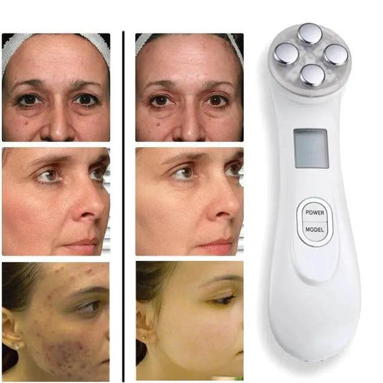 Genève™ Skin Rejuvenation Device – Genève Aesthetics™
